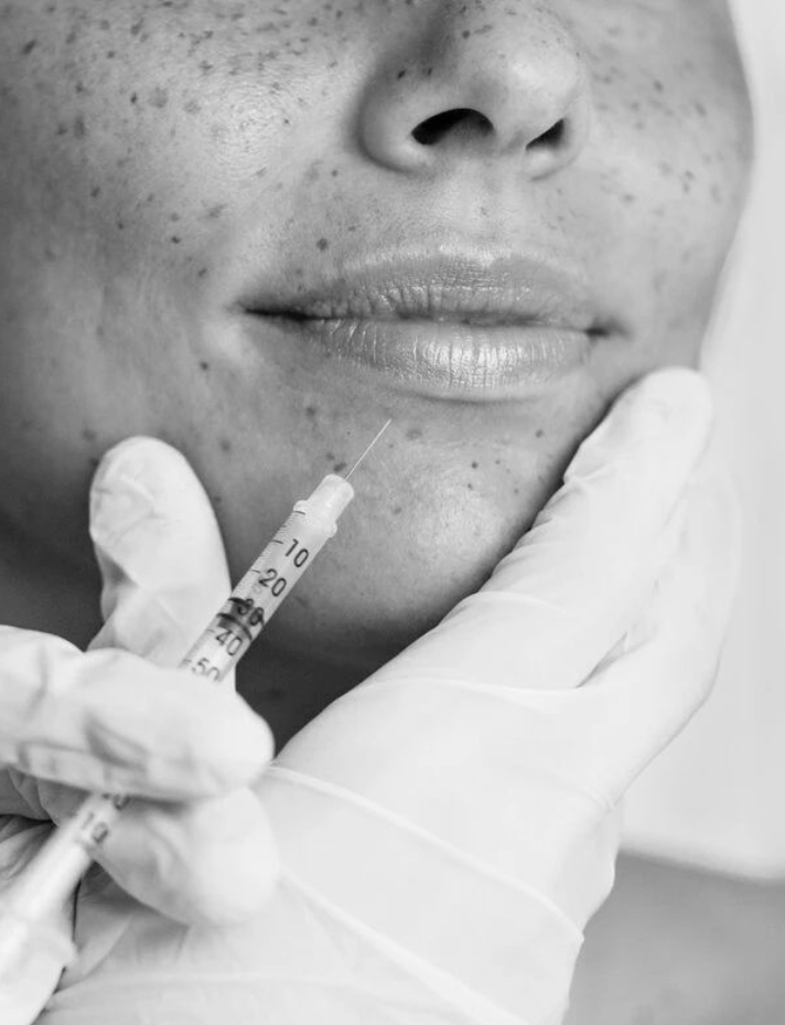 Volume & contour – Nōré Clinic